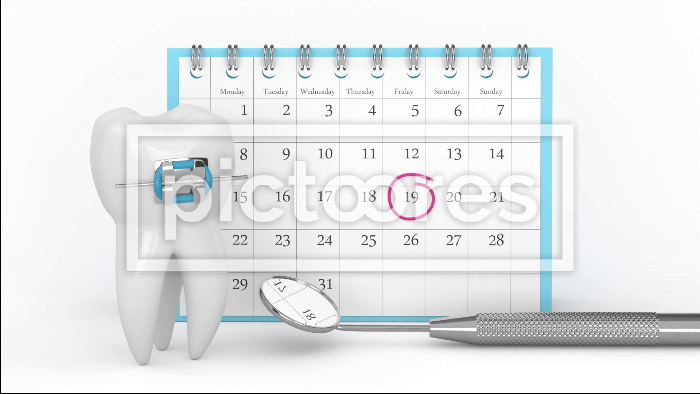 Calendar with the date of the visit to the orthodontist