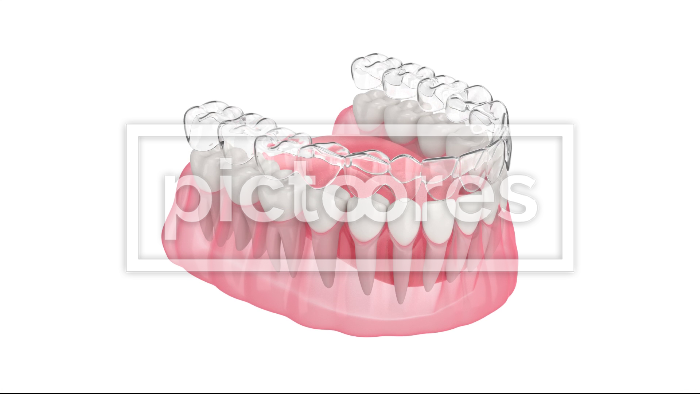 Clear invisalign aligner splint make toothing correction