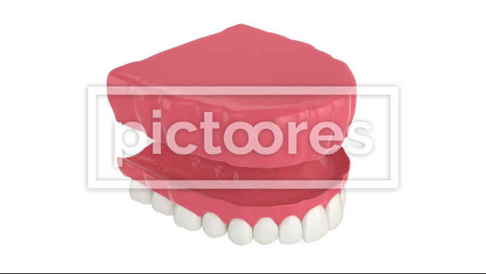 Removable traditional denture installation