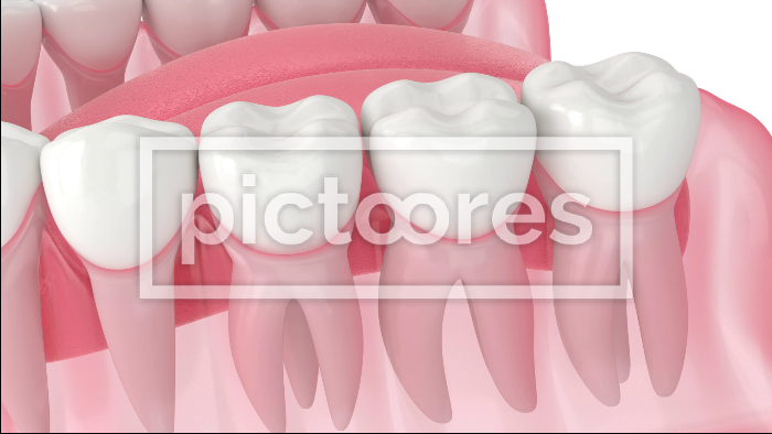 Space maintainer and new tooth growth process