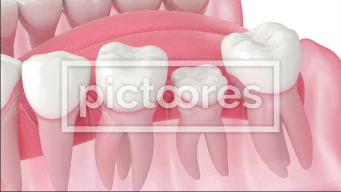 Tooth growth problems