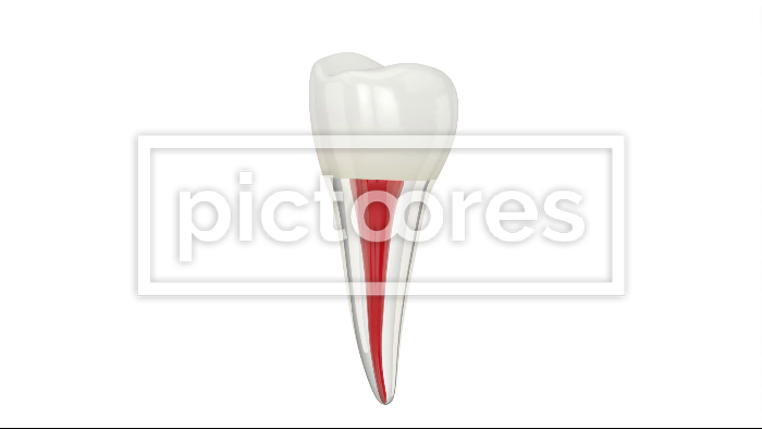 Premolar tooth with visible canal root