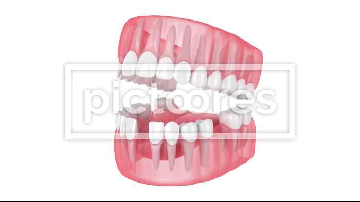 Translucent jaw with missing teeth